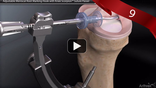 Arthrex - Helping Surgeons Treat Their Patients Better™