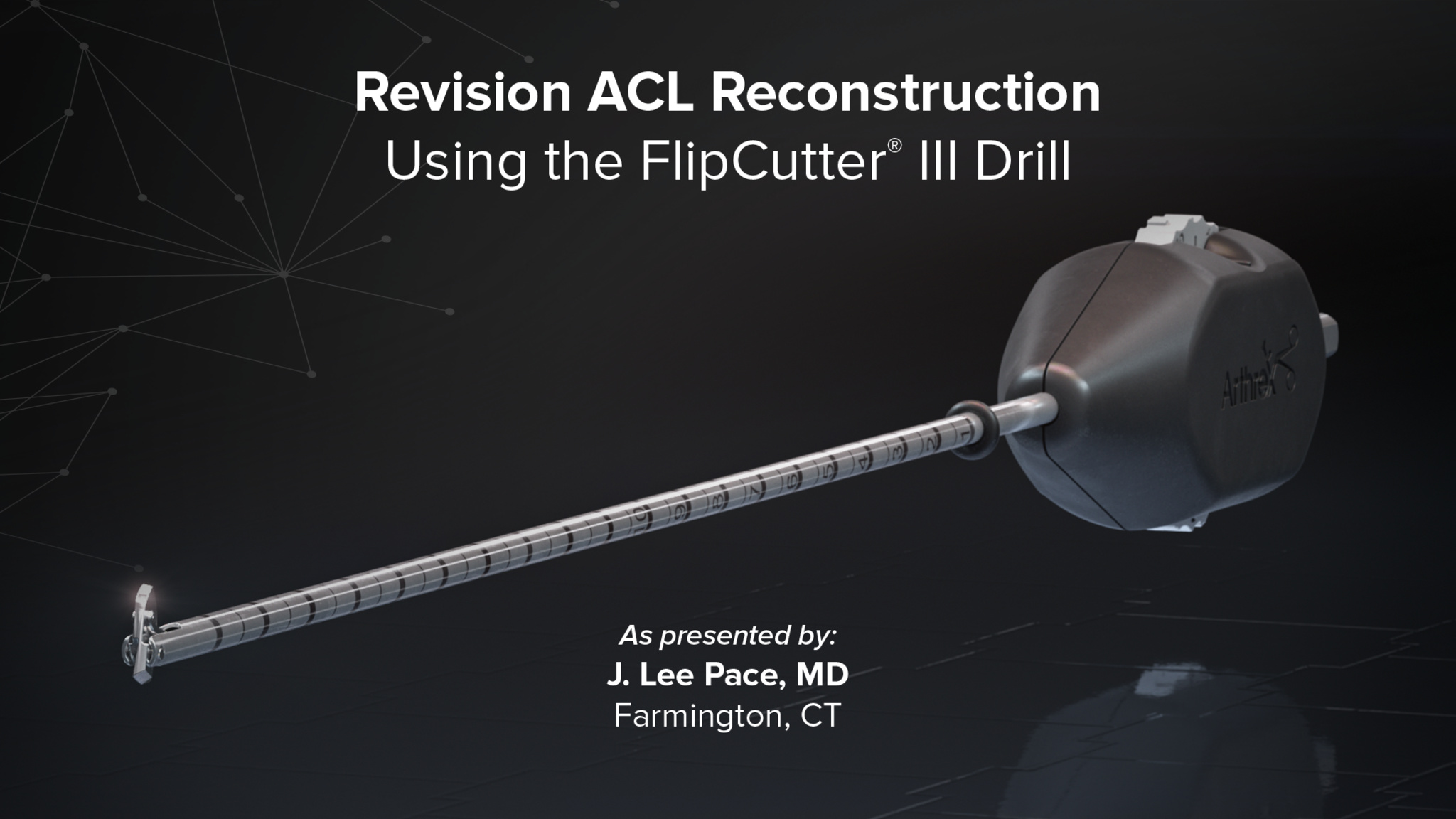 Arthrex - Revision ACL Reconstruction Using the FlipCutter® III Drill