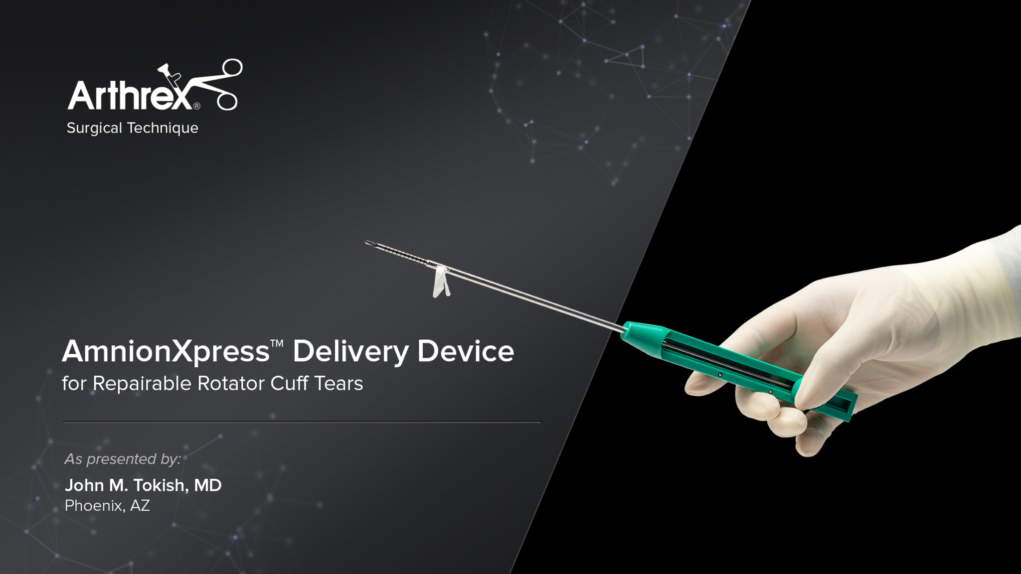 Arthrex - AmnionXpress™ Delivery Device for Repairable Rotator Cuff Repairs