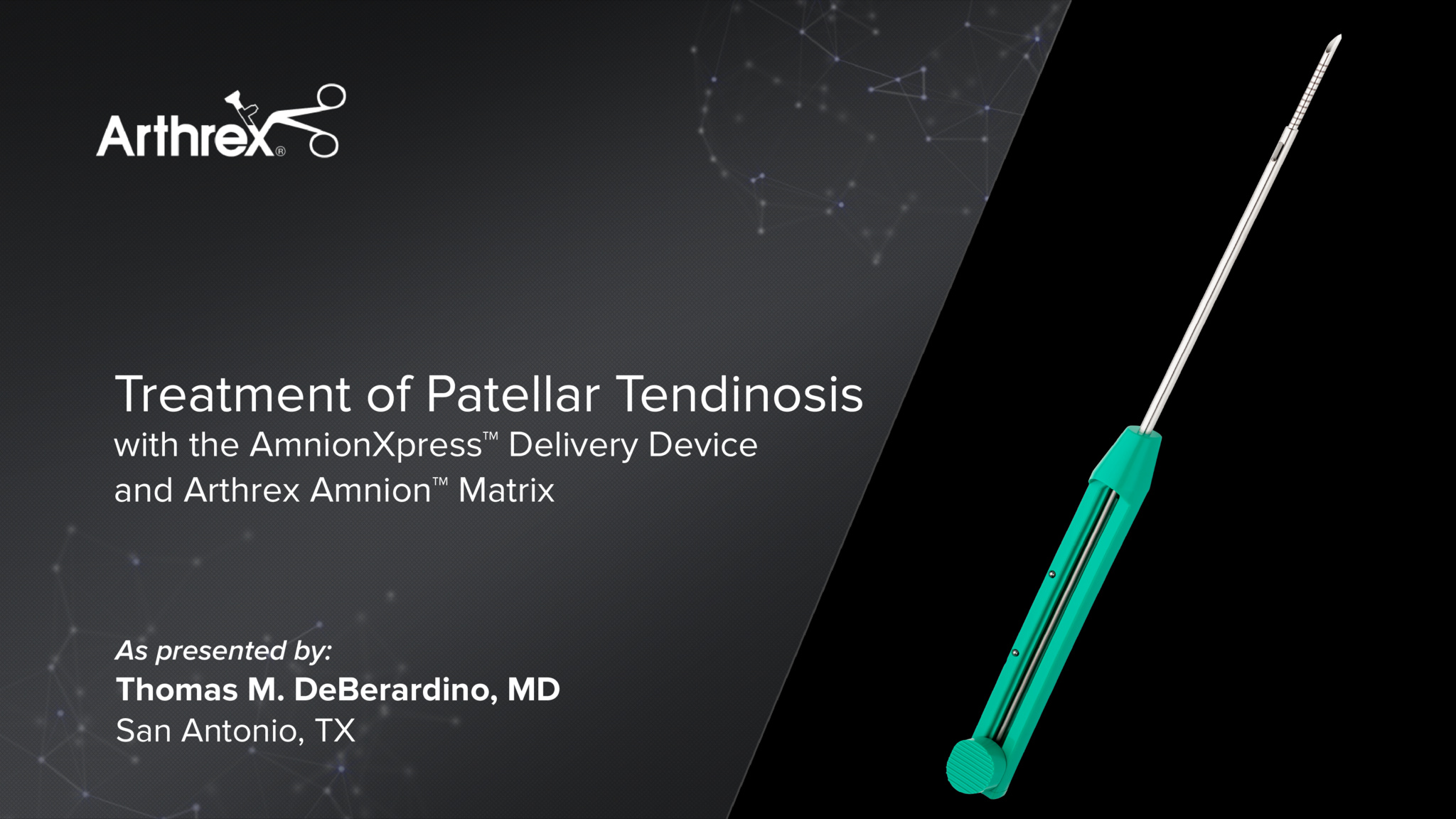 Arthrex - Treatment of Patellar Tendinosis With the AmnionXpress ...