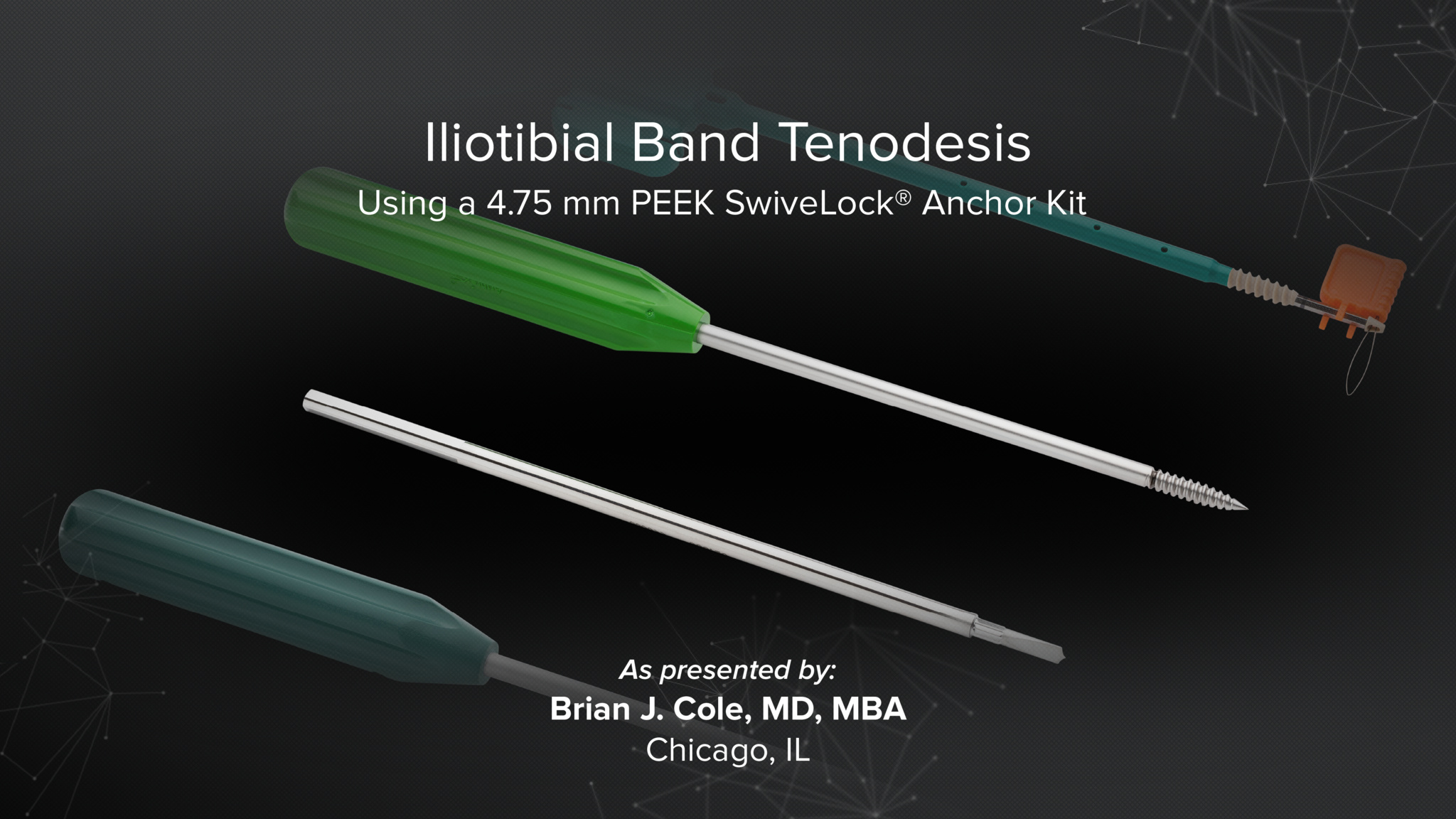Arthrex - Iliotibial Band Tenodesis Using a 4.75 mm PEEK SwiveLock ...