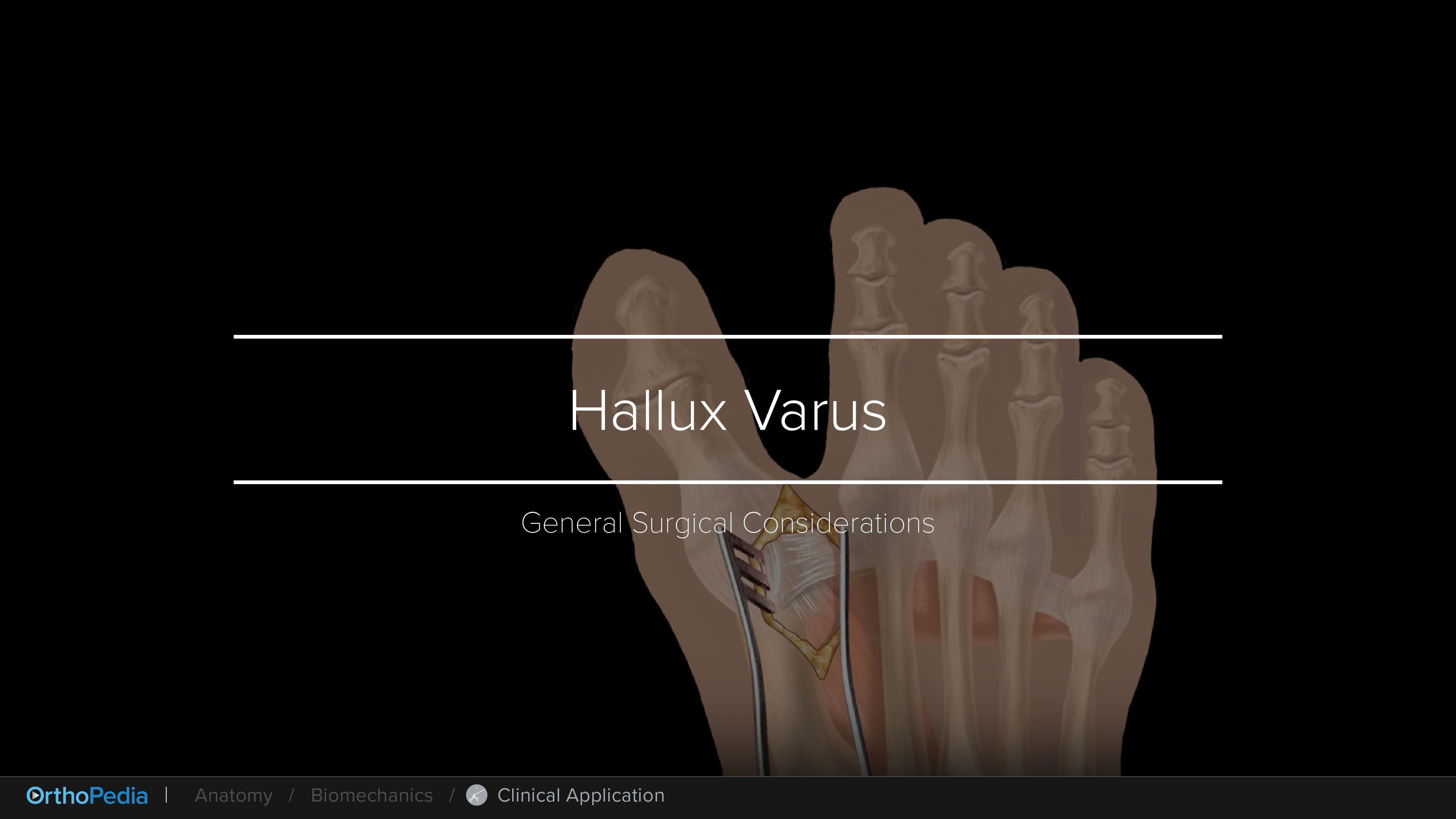Hallux Varus: General Surgical Considerations