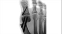 Arthrex - Minimally Invasive Surgery
