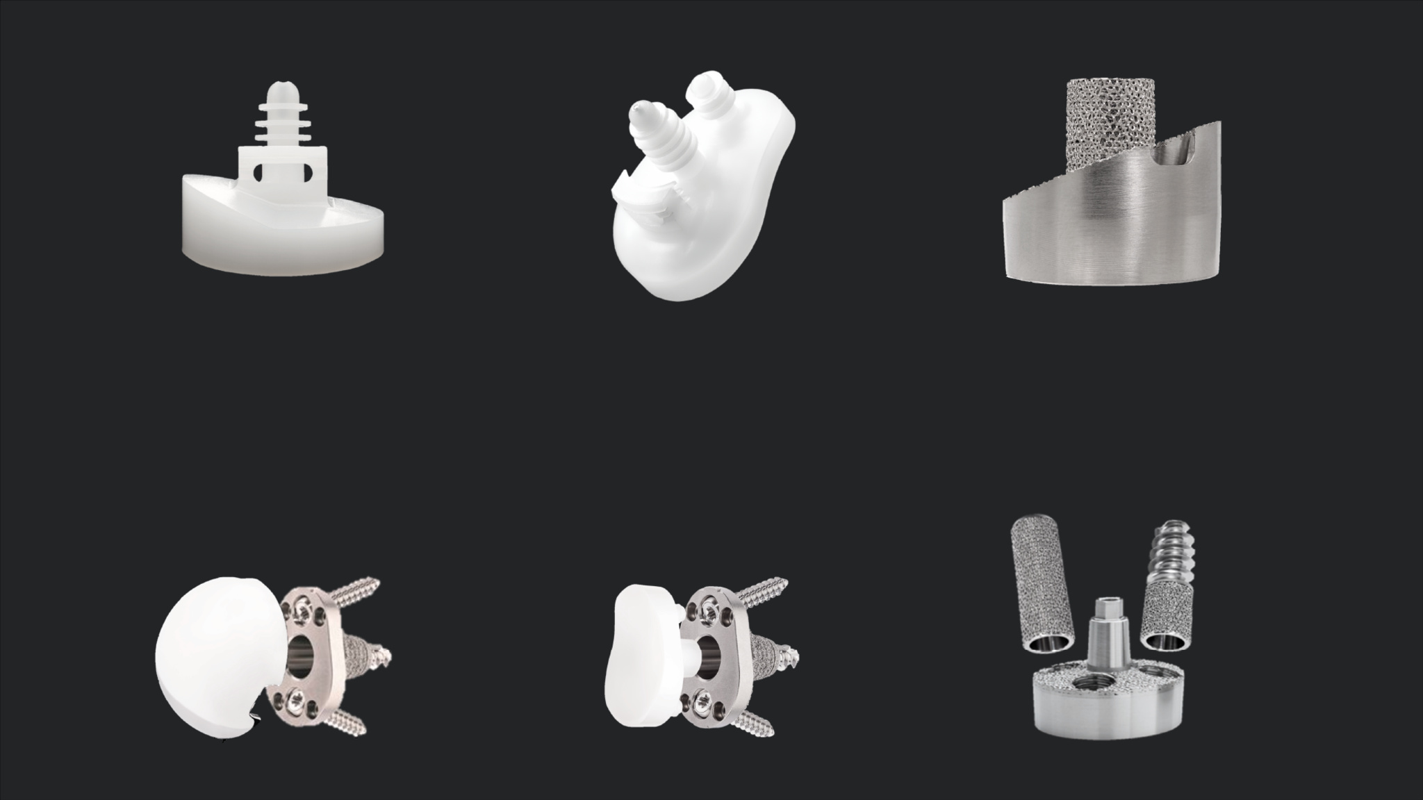 Arthrex - Glenoid Treatment Options: Managing Complex Morphology With ...