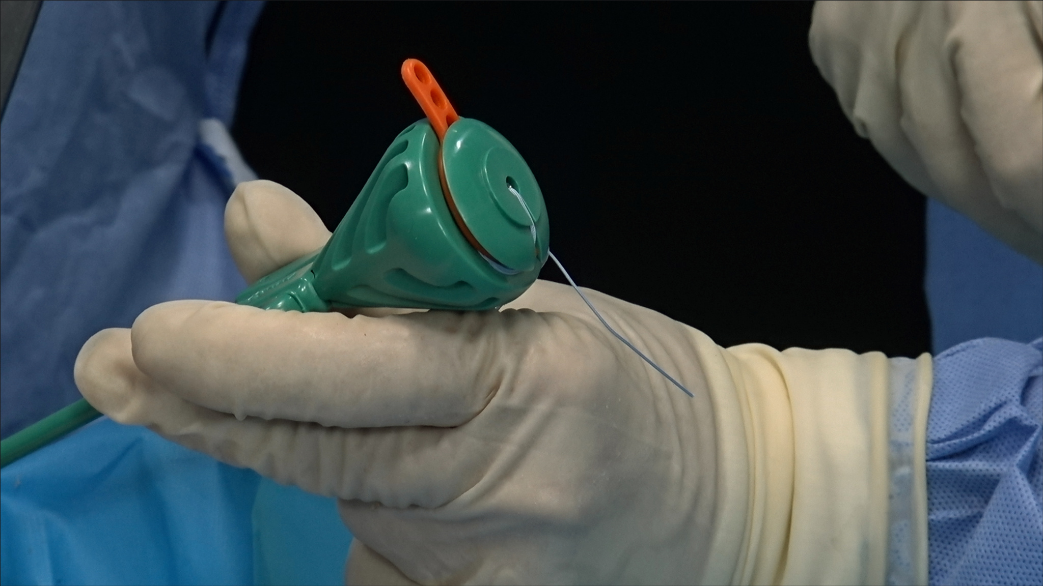 Arthrex Open Proximal Hamstring Tendon Repair Using A Knotless