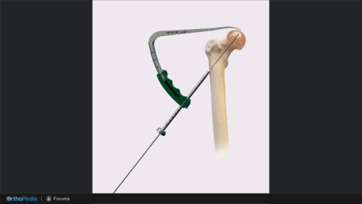 Arthrex - Helping Surgeons Treat Their Patients Better™