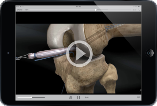 Arthrex - Arthrex News