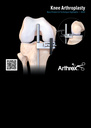 Arthrex - Arthroplasty Knee