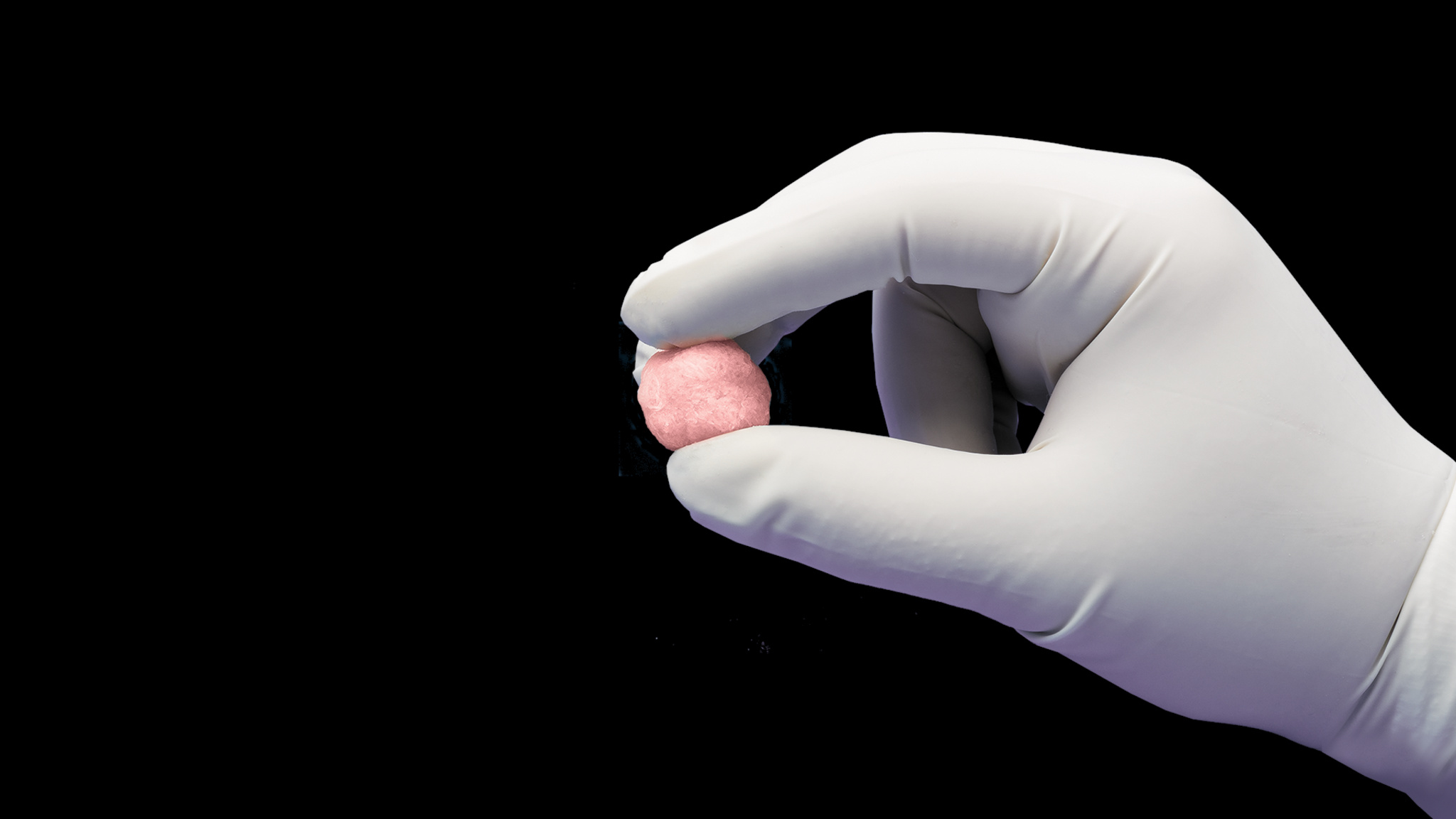 Arthrex - ArthroCell™ Viable Bone Graft for Spinal Fusion Procedures