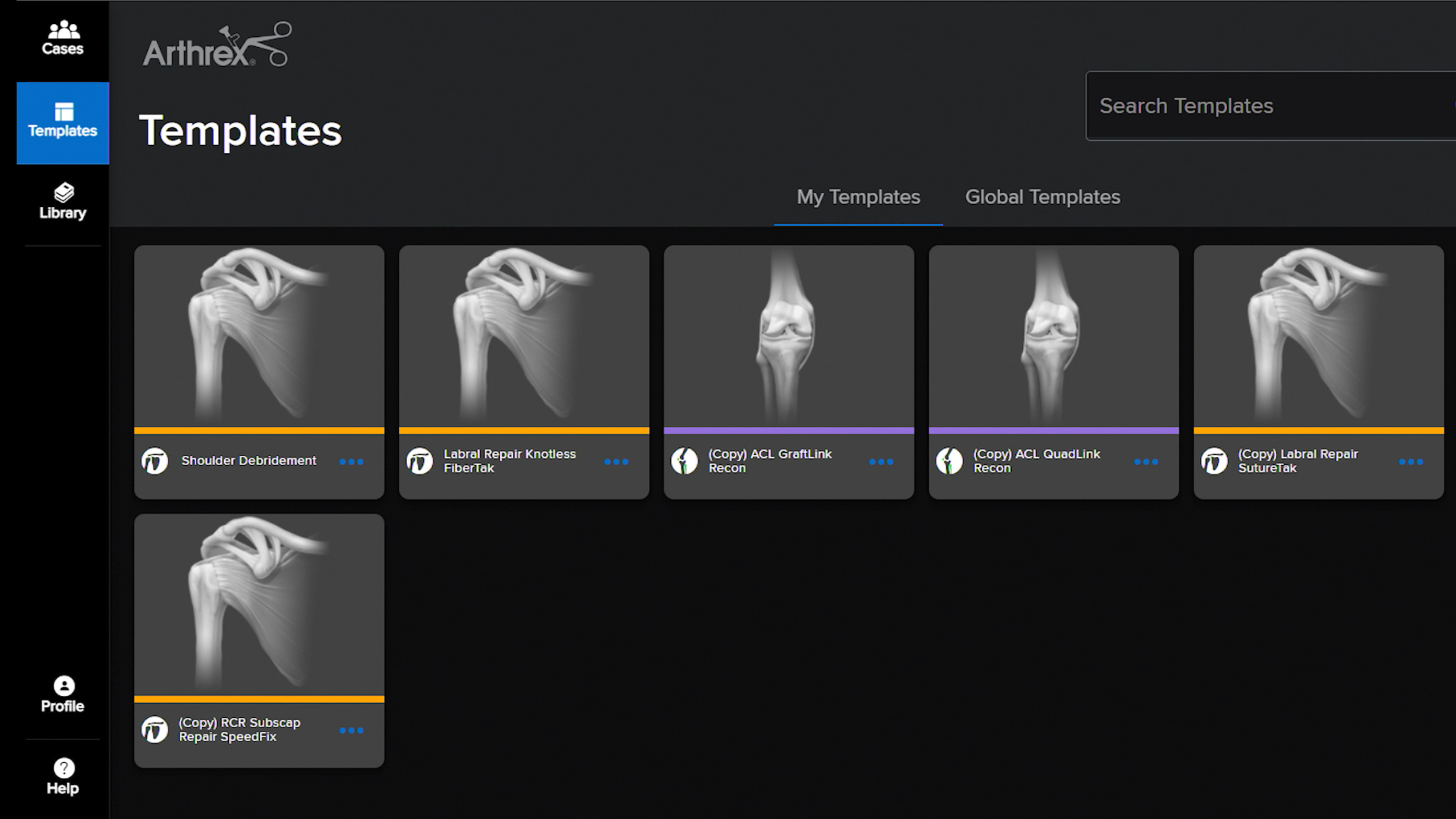 Arthrex - New SurgeonVault® System: Editing Templates and Adding Content