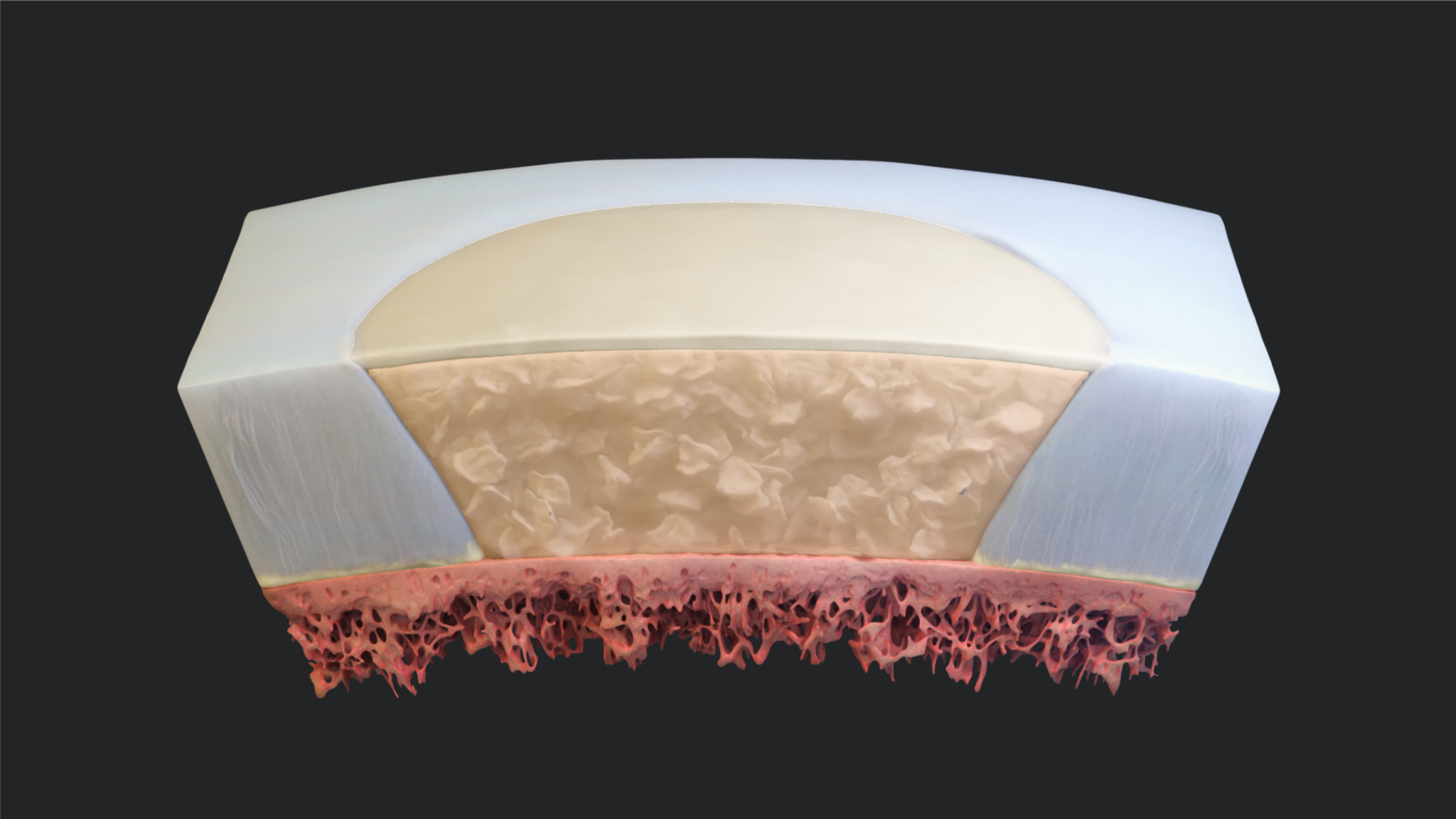 Arthrex - AutoCart™ Procedure Surgical Technique