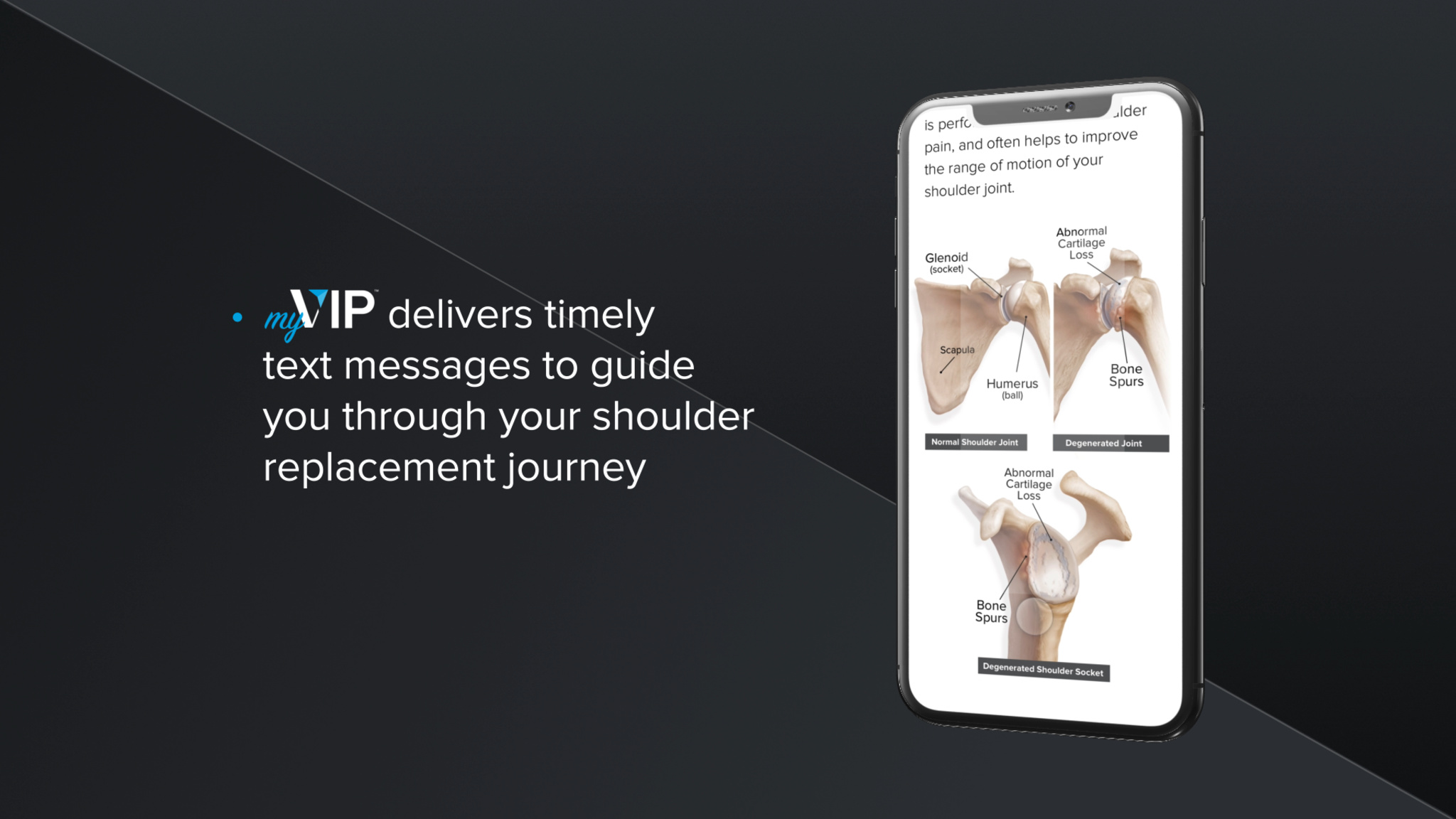 Arthrex - MyVIP Patient Texting Platform - Dravecky