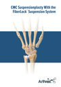 Arthrex - FiberLock CMC Suspensionplasty