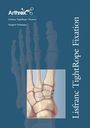 Arthrex - Lisfranc Injury Fixation
