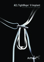 Arthrex - ACL TightRope® II Implant