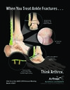Arthrex - InternalBrace™ Ligament Augmentation Repair