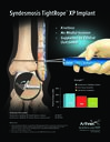 Arthrex - TightRope®