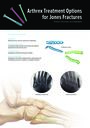 Arthrex - Jones Fracture Repair