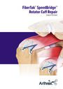Arthrex - FiberTak® SpeedBridge™ Rotator Cuff Repair