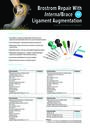 Arthrex - InternalBrace™ Procedure for Brostrom Repair