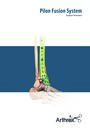 Arthrex - Pilon Fusion Plating System