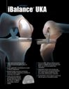 Arthrex - iBalance® UKA System