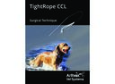 Arthrex - TightRope® Fixation System