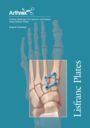 Arthrex - Lisfranc Arthrodesis