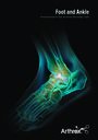 Arthrex - Ankle Fracture Management System