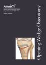 Arthrex - Opening Wedge Osteotomy Instrument Set