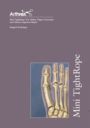 Arthrex - Mini TightRope® Fixation System