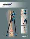 Arthrex - Ankle Fracture Management System