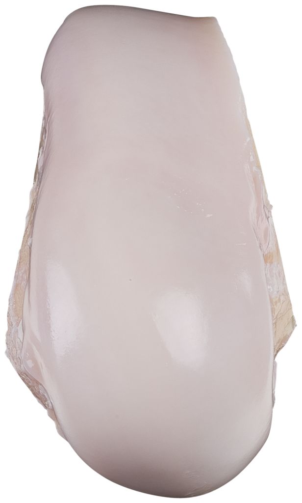 Arthrex - Medial Femoral Hemi-Condyle, Left - 32247002