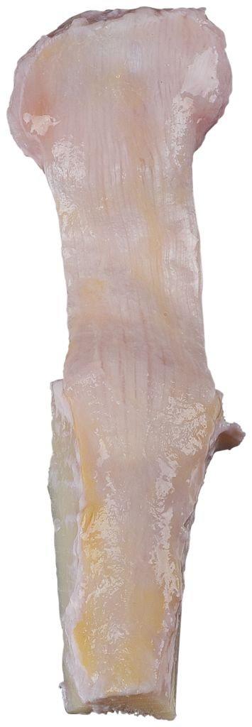 Arthrex - Patella Bone w/ Attachment, Left - 33647002