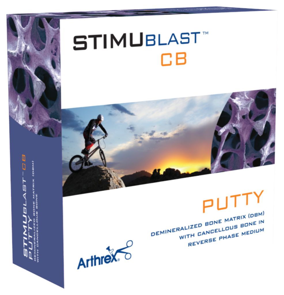 Arthrex - StimuBlast CB Putty, 10 cc - ABS-2003-10