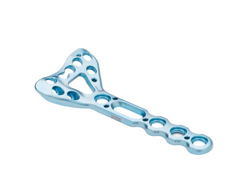 Arthrex - Volar Distal Radius Plate, Wide, Left, 5 Hole - AR-8916VWL-05