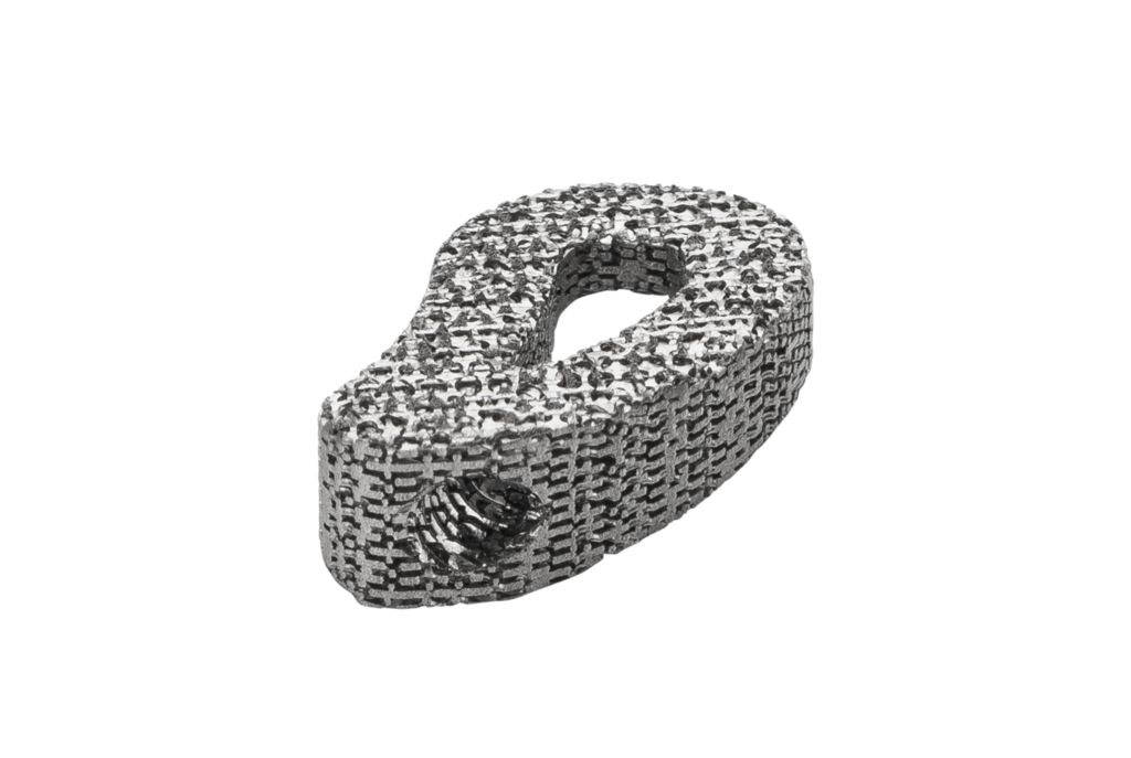 Arthrex - BioSync Anatomic Cotton Wedge, 16 x 6.5 mm - AR-8948W-1665