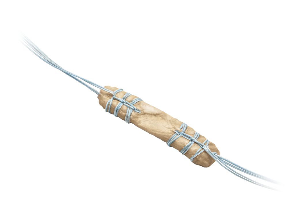 Arthrex - QuadLink Construct Tendon - FQL