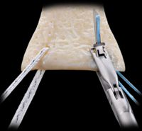 Arthrex - Helping Surgeons Treat Their Patients Better™