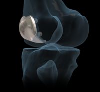 Arthrex - Helping Surgeons Treat Their Patients Better™