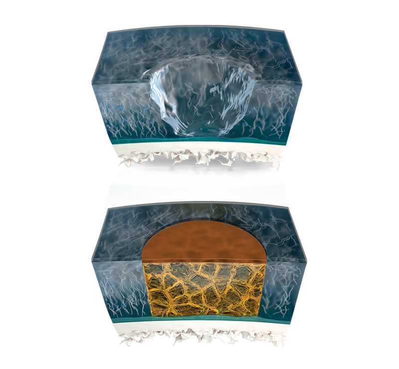 Arthrex - AutoCart™