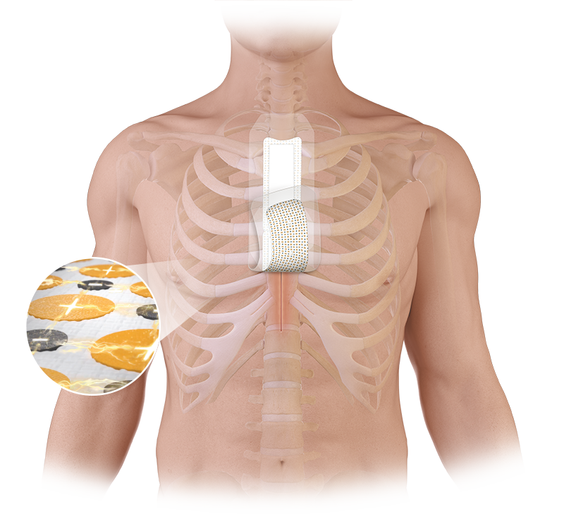 Arthrex - JumpStart® Antimicrobial Wound Dressing