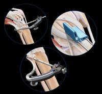 Arthrex - Helping Surgeons Treat Their Patients Better™