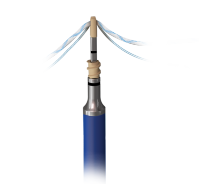 Arthrex - Hand/Wrist InternalBrace™ Ligament Augmentation Repair