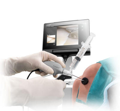 Arthrex - Nano Arthroscopy