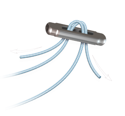 Arthrex - Cortical Button Fixation