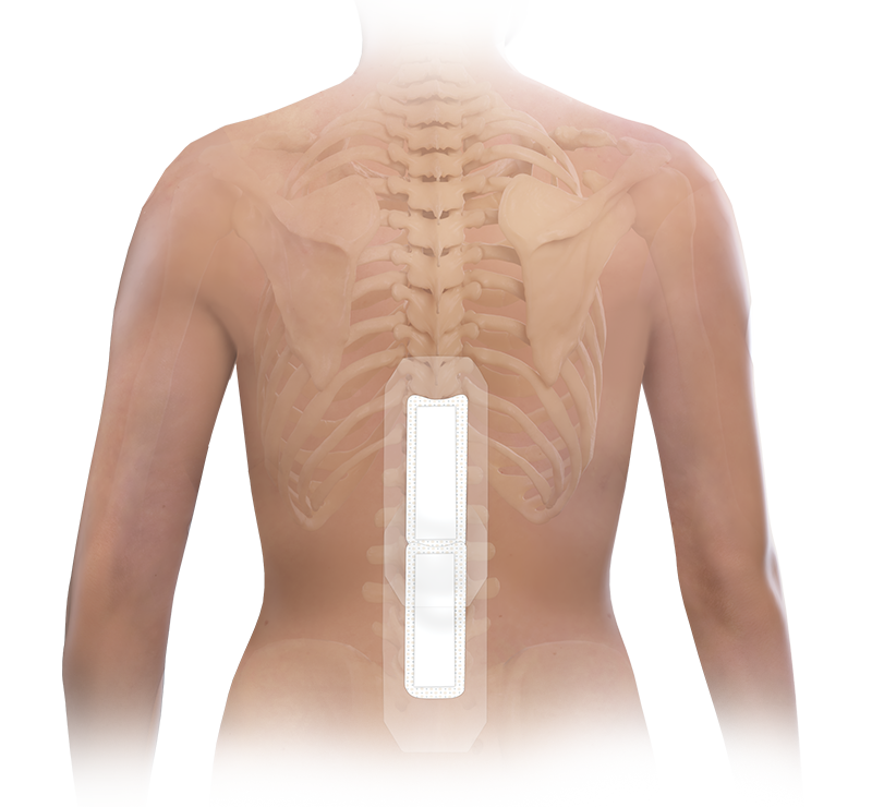 Arthrex - JumpStart® Antimicrobial Wound Dressing