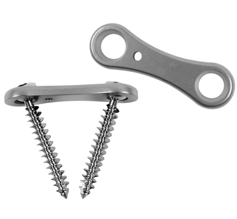 Arthrex - Two-Hole Osteotomy Support Plate Implant System