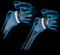 Arthrex - Helping Surgeons Treat Their Patients Better™