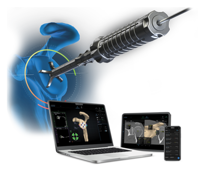 Arthrex - Sistema Virtual Implant Positioning™ (VIP)